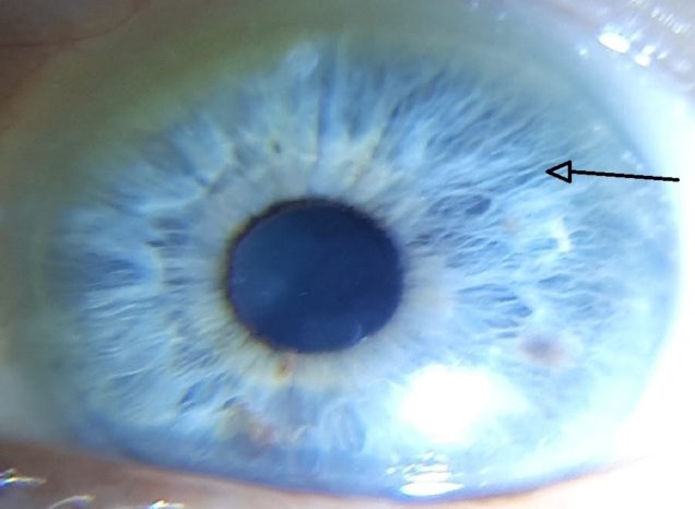 Comprendre l'iridologie, partie 1: les bases - Supernaturo