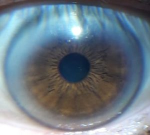 Comprendre l'iridologie, partie 1: les bases - Supernaturo